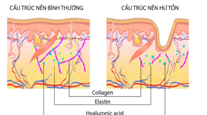 Ra mắt Chỉ Collagen K:OM công nghệ đặc biệt từ Nhật Bản - Tinh hoa chăm ...